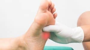 Cuboid Syndrome: How to Treat Cuboid Syndrome by a Specialist