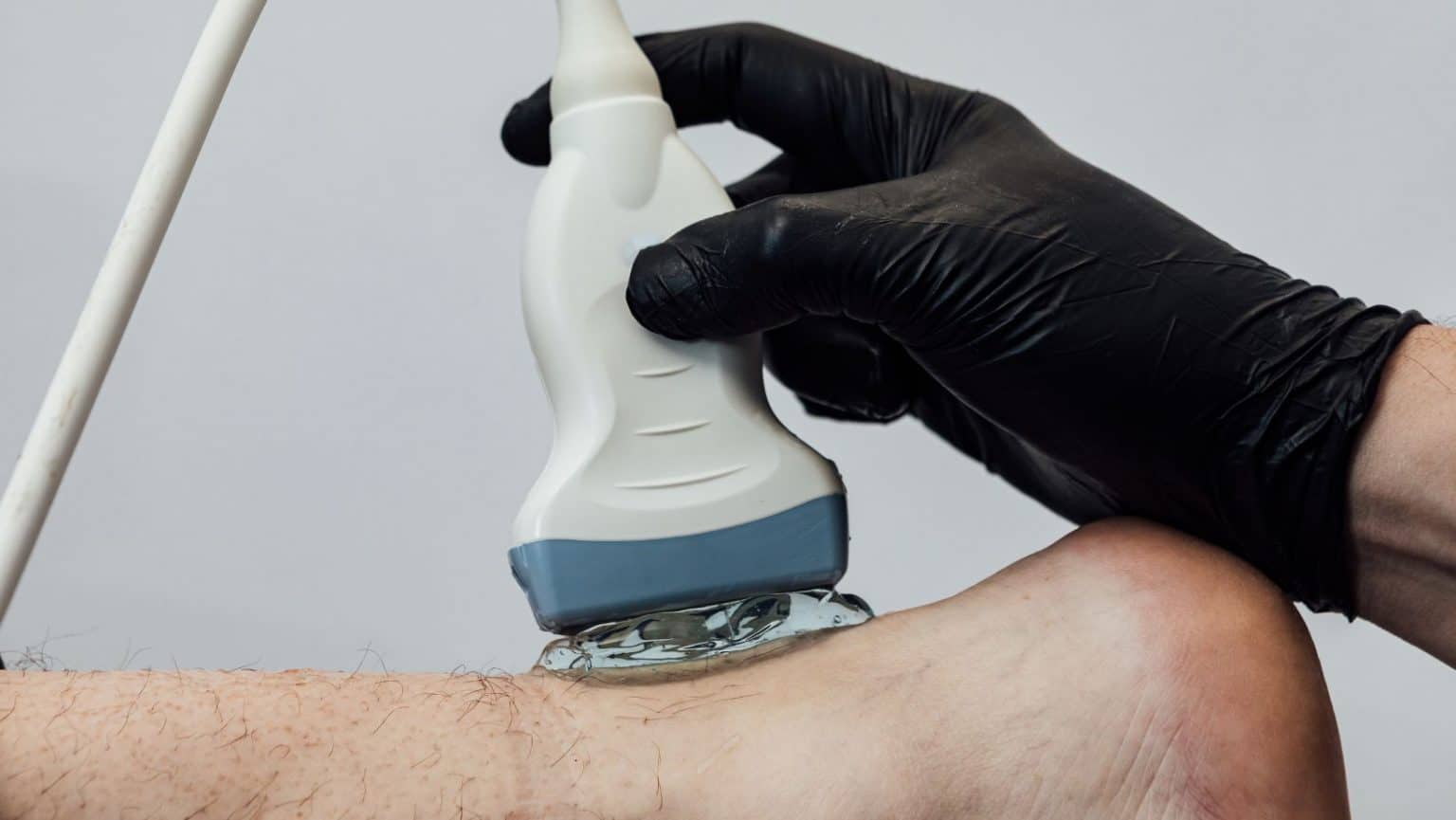 Achilles Paratenonitis Achilles Tenosynovitis How To Treat Paratenonitis achilles-paratenonitis-achilles-tenosynovitis-how-to-treat-paratenonitis