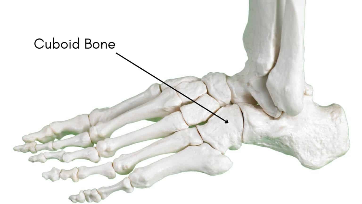 Cuboid Fracture | Cuboid Bone Fracture: Symptoms and Treatment