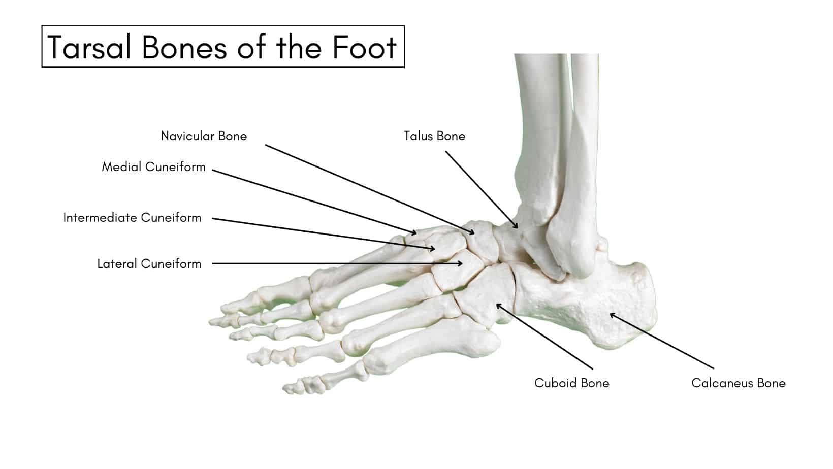 Tarsal Coalition: Symptoms, Diagnosis and Treatment